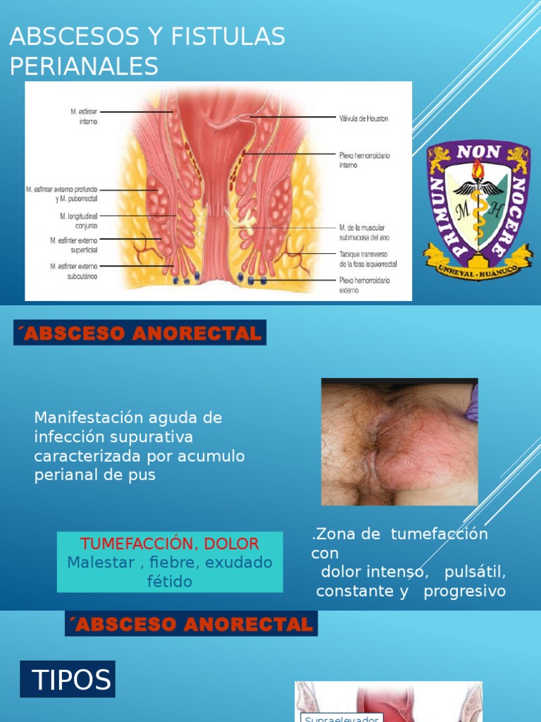 Abscesos Abscesos Y FÍSTULAS PERIANALESy Fistulas Perianales | PDF