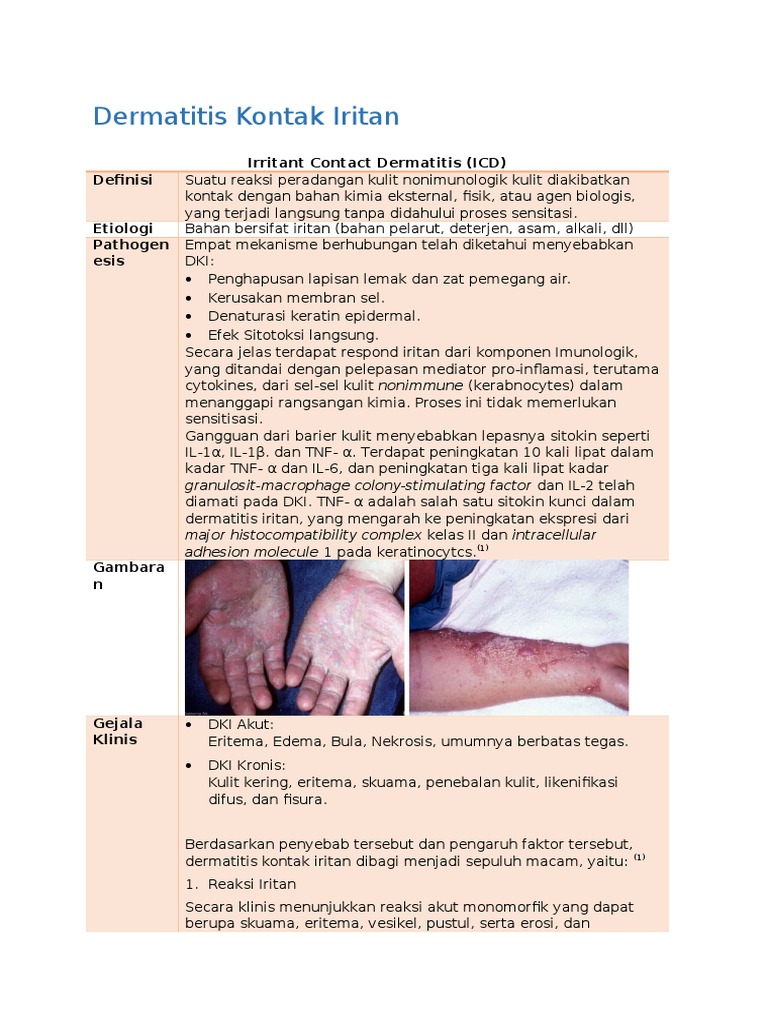 1.1 - Dermatitis Kontak Iritan | PDF