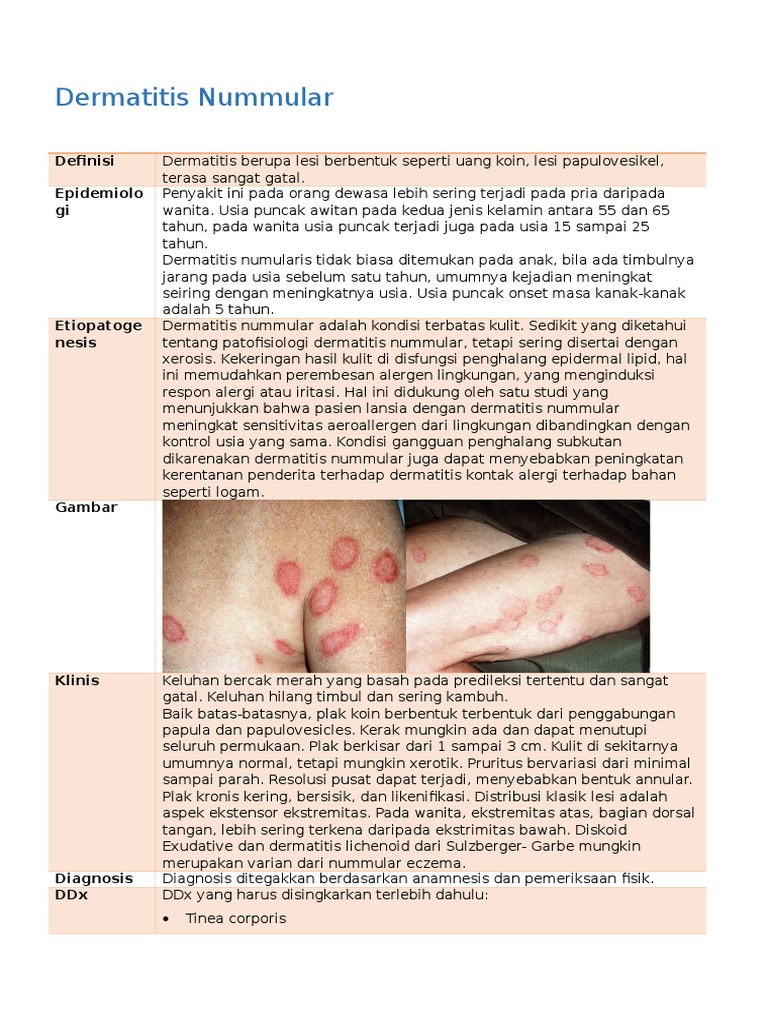 1.4 - Dermatitis Nummular | PDF