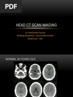 How To Read A Head CT Scan | PDF | Ct Scan | Clinical Medicine
