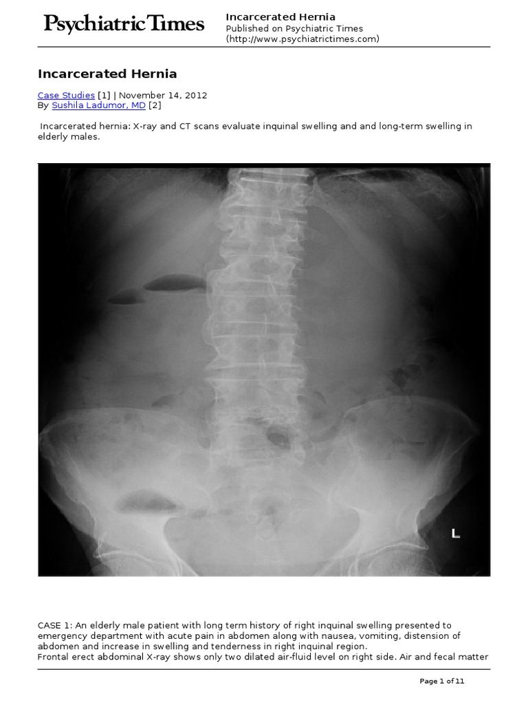 Incarcerated Hernia: Case Studies Sushila Ladumor, MD | PDF | Medicine ...