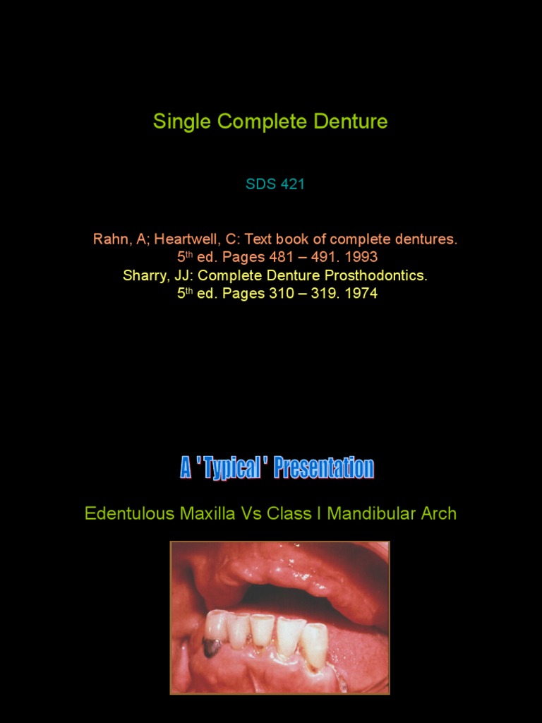 Single Complete Denture Syndrome | PDF | Dentures | Dentistry Branches