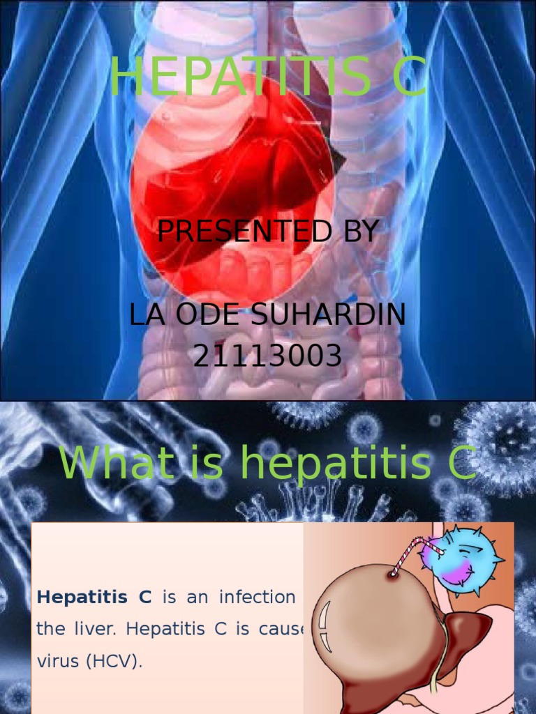 Understanding Hepatitis C Basics | PDF | Self-Improvement | Science ...