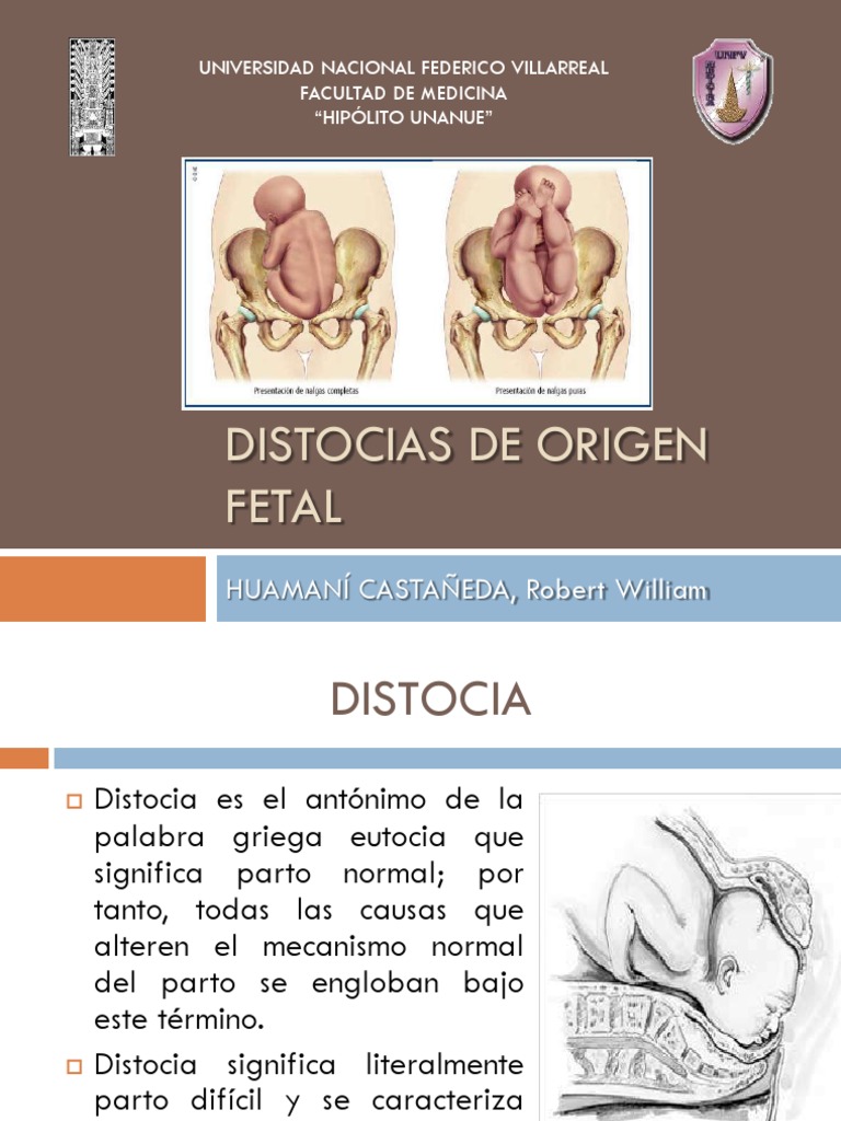 Distocias de Origen Fetal | PDF | Parto | Reproducción humana