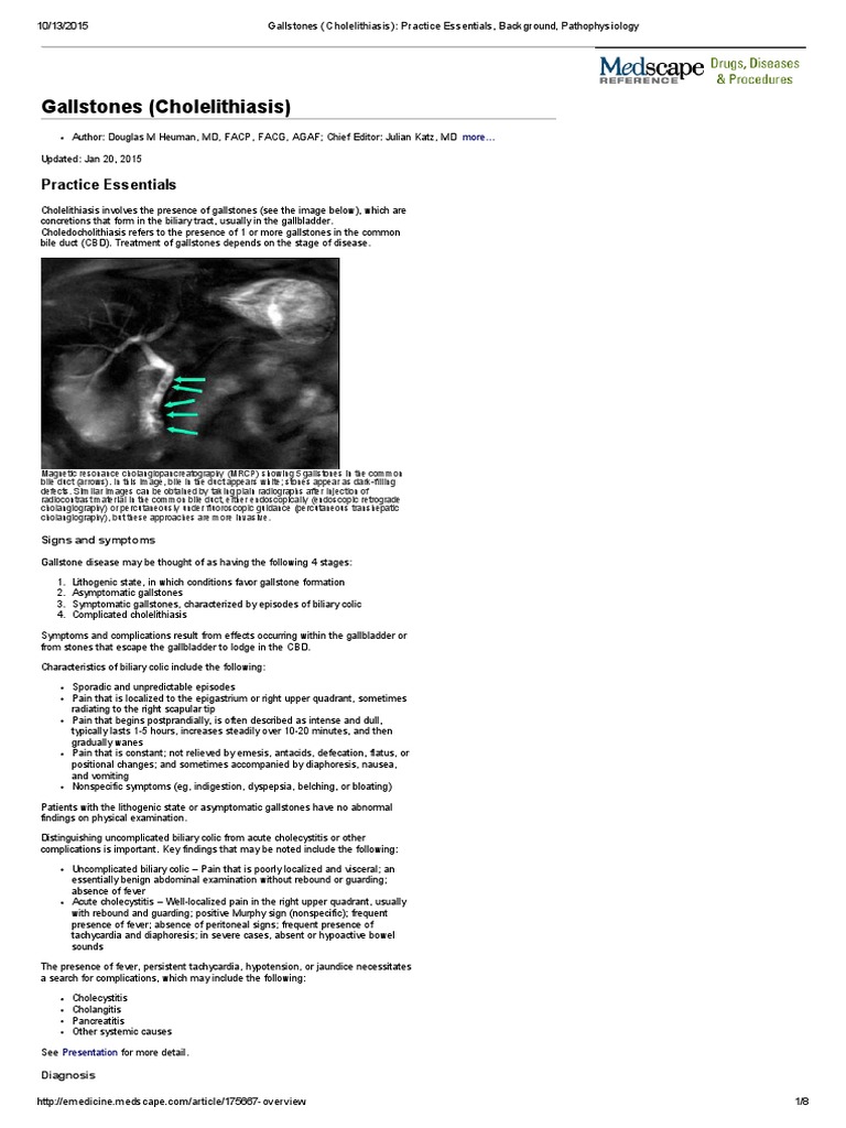 Gallstones (Cholelithiasis) - Practice Essentials, Background ...