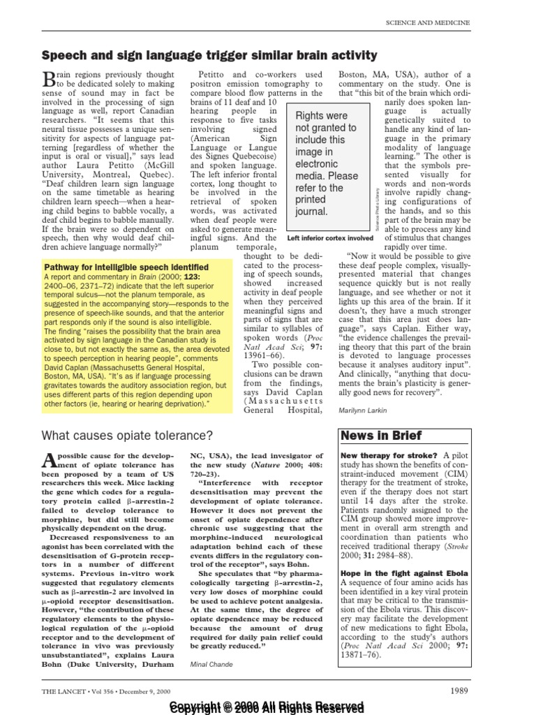 Speech and Sign Language Trigger Similar Brain Activity | PDF | Hearing ...