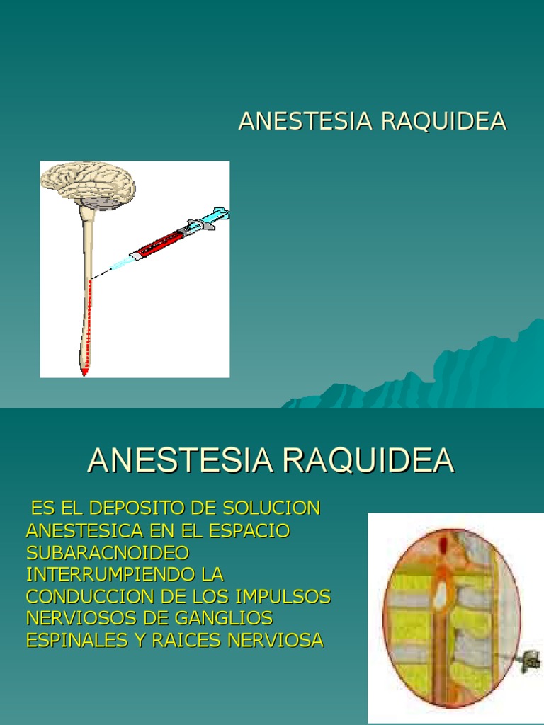 Anestesia Raquidea | PDF | Anatomía humana | Anatomia animal