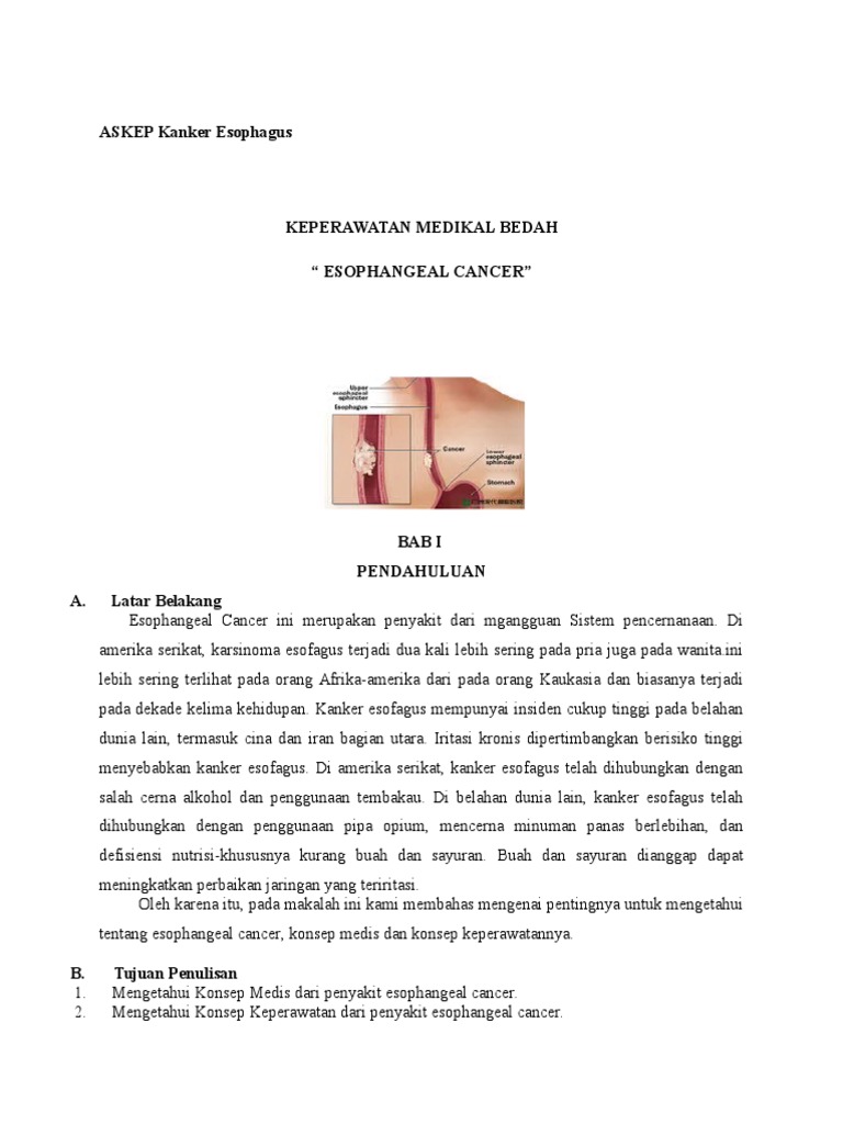 ASKEP Kanker Esophagus | PDF