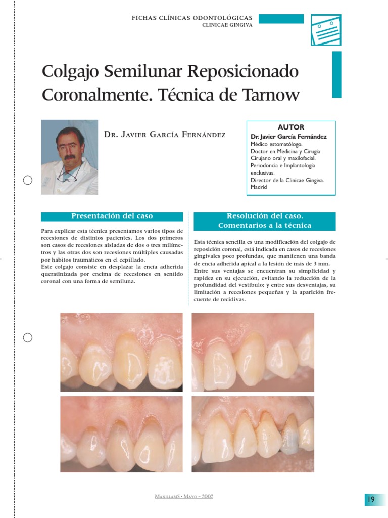 Fichas - PDF Incision Semilunar | PDF | Odontología | Especialidades ...