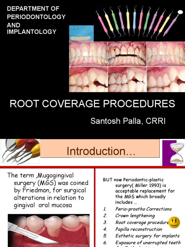 Root Coverage Techniques in Periodontics | PDF | Dental Implant | Human ...