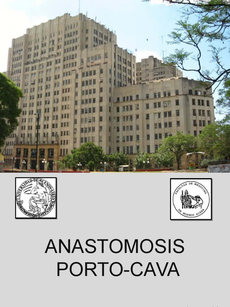 Anastomosis Portocava | PDF | Abdomen | Sistema digestivo