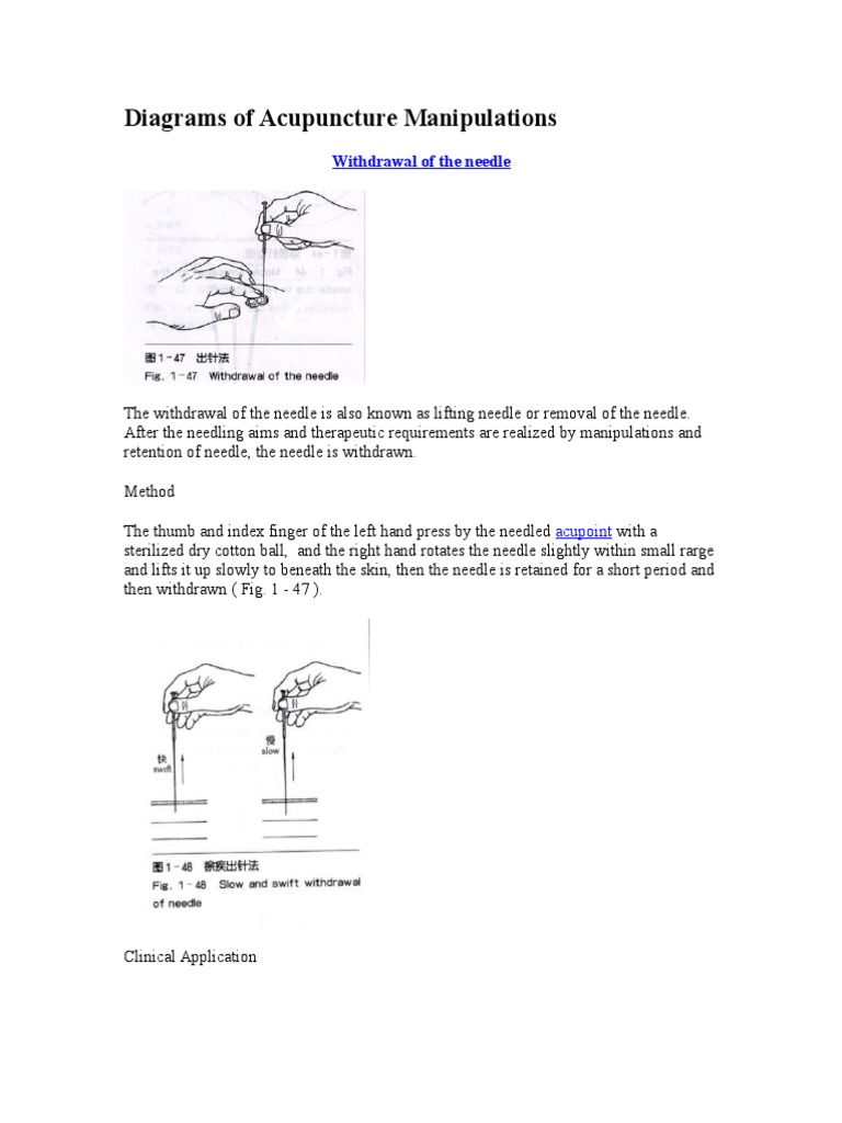 Diagrams of Acupuncture Manipulations | PDF | Acupuncture | Clinical ...