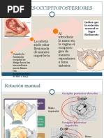 Prolapso y procúbito de cordón umbilical | PDF | Parto | Reproducción ...