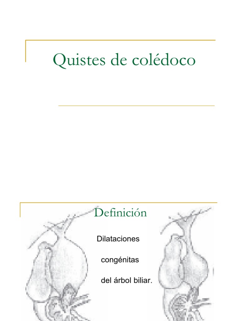 Quiste de Coledoco | PDF | Sistema digestivo | Gastroenterología