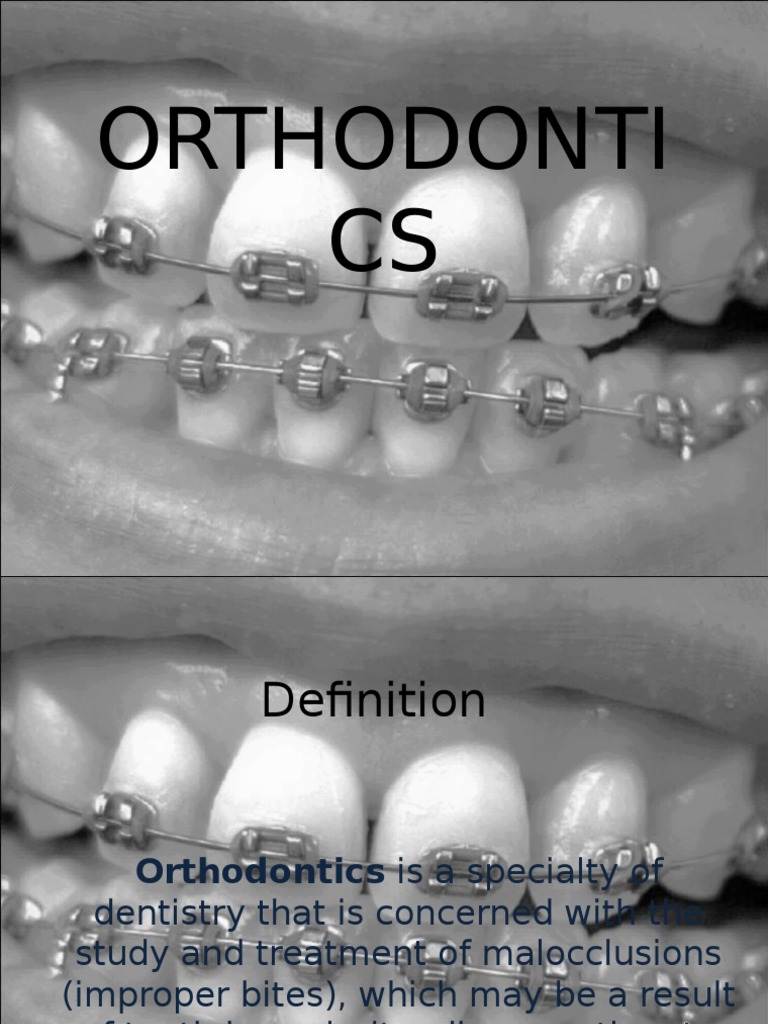 Orthodontics | PDF | Orthodontics | Dentistry