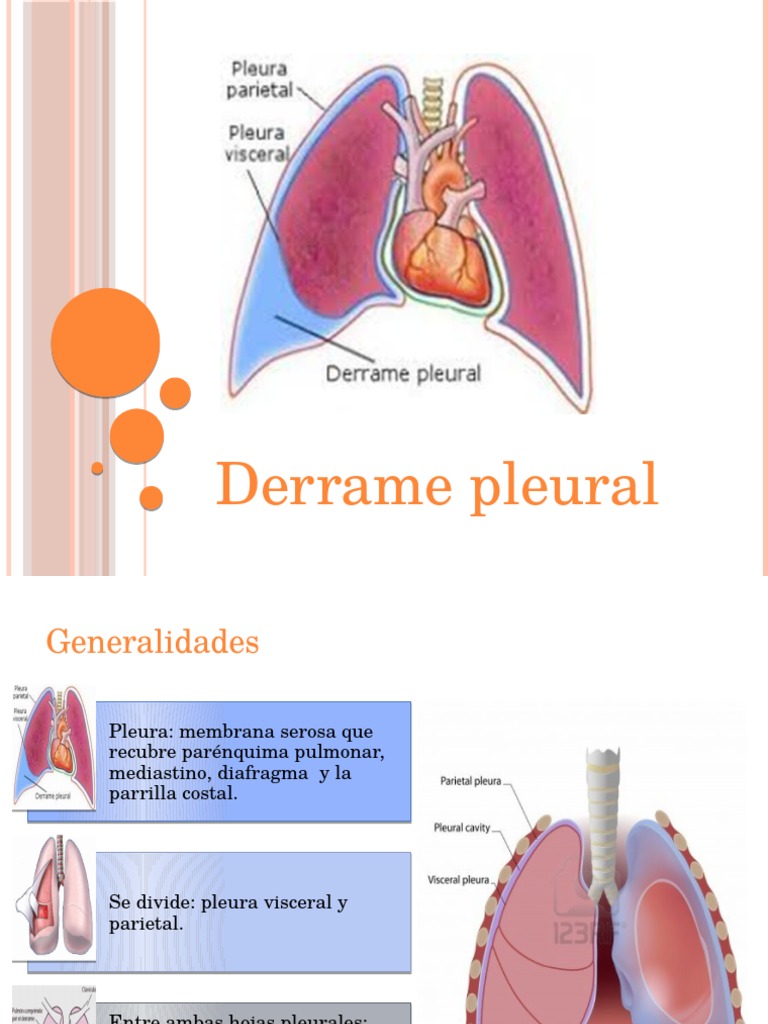 Derrame Pleural | PDF | Sistema respiratorio | Especialidades Medicas