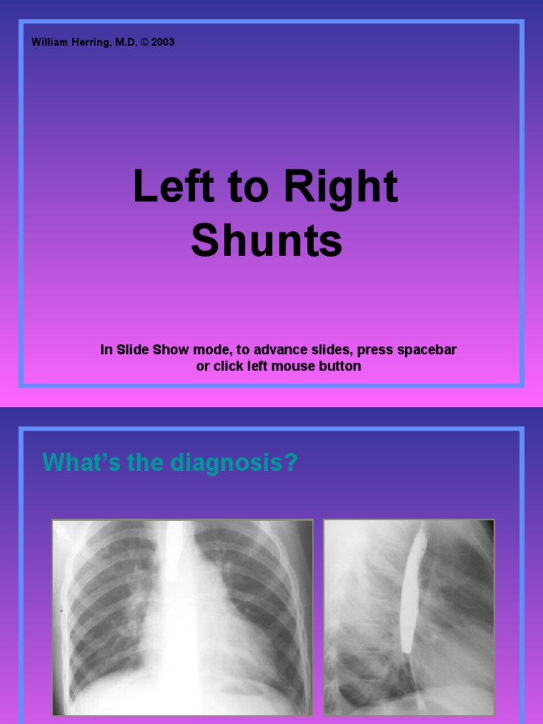 L-R Shunt | PDF | Heart Valve | Congenital Heart Defect