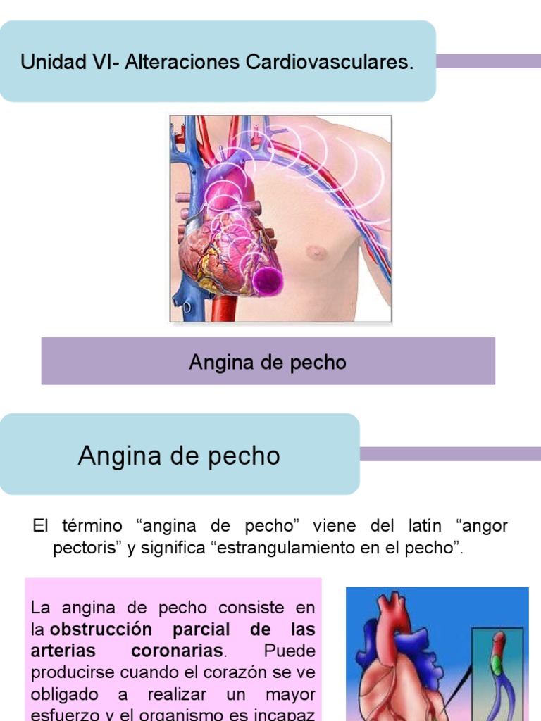Angina de Pecho | Angina de pecho | Infarto de miocardio | Prueba ...