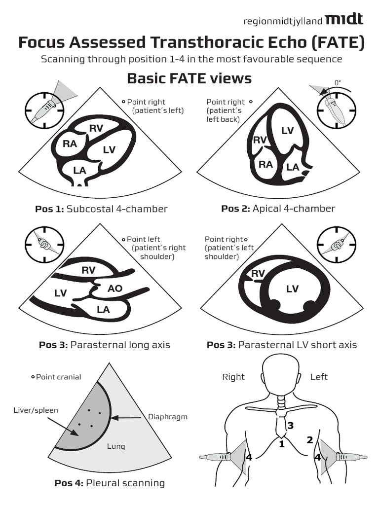 Cardiology.echo Fate Card-2 | Ventricle (Heart) | Heart