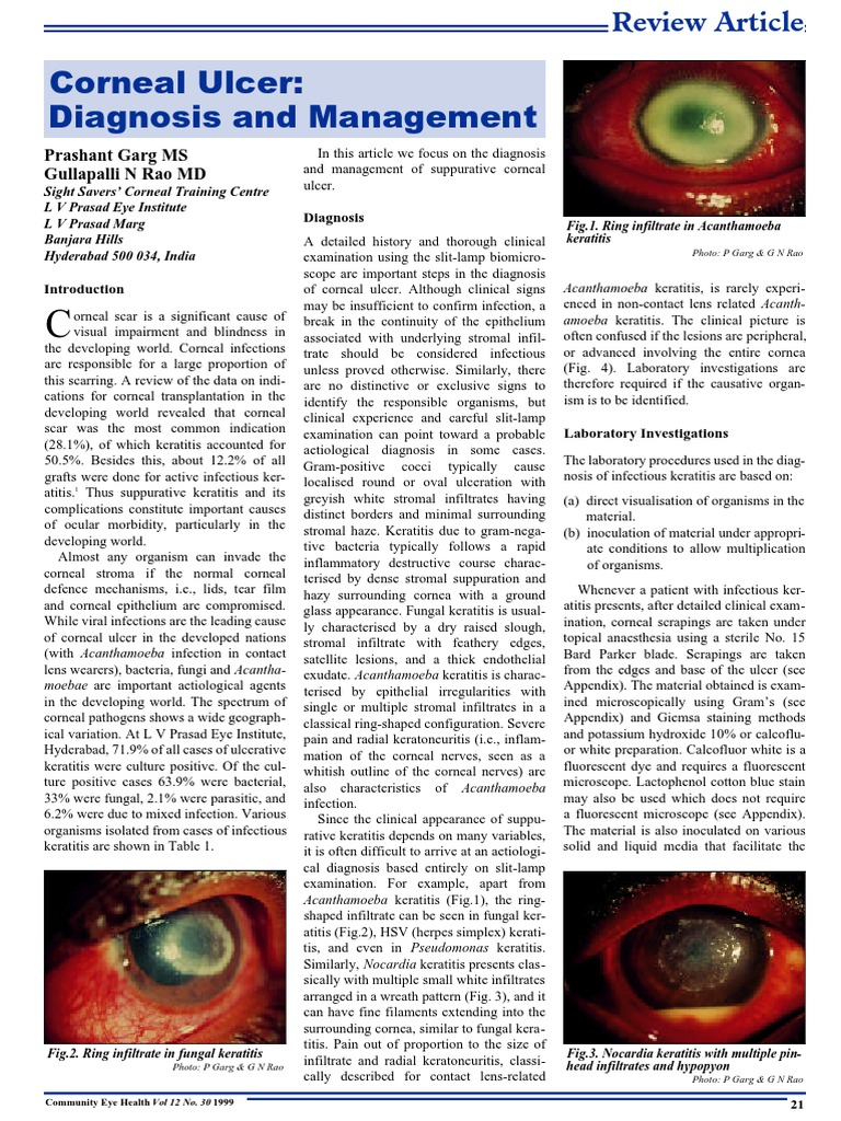 Ulkus Kornea | PDF | Cornea | Infection