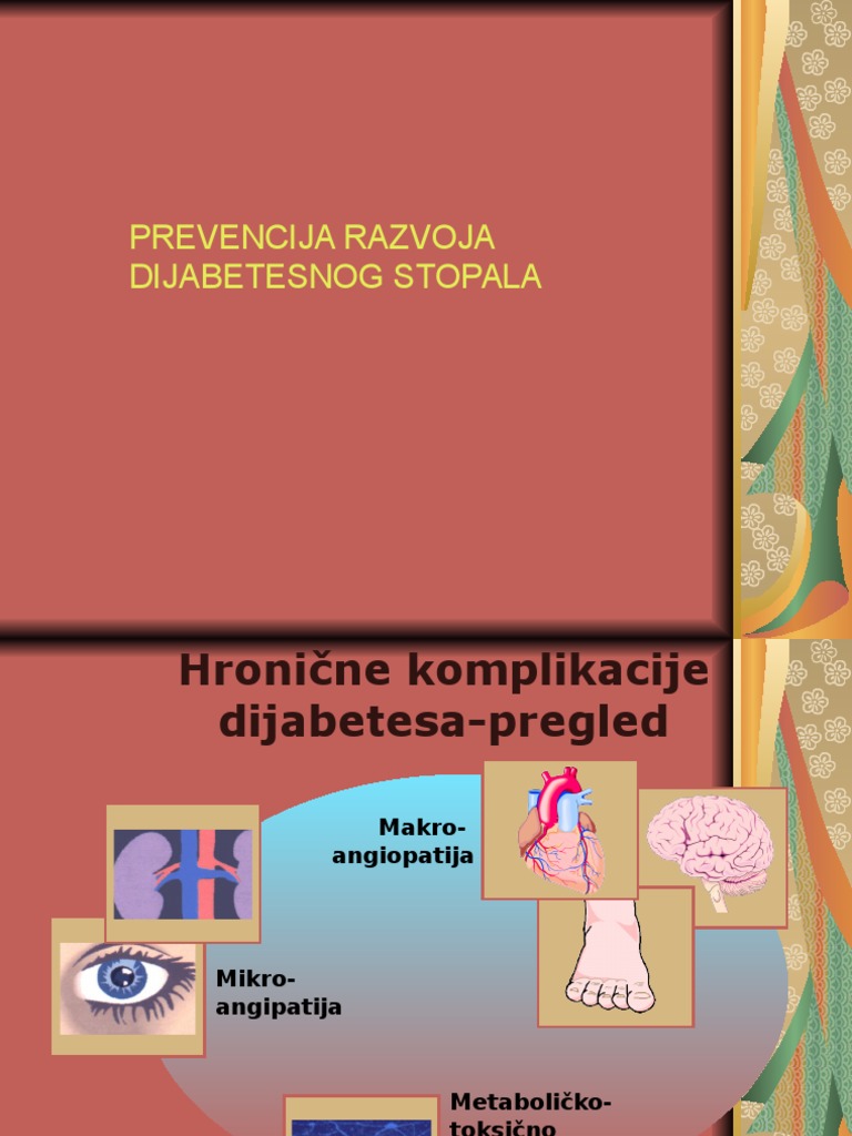 Dijabetesno Stopalo | PDF