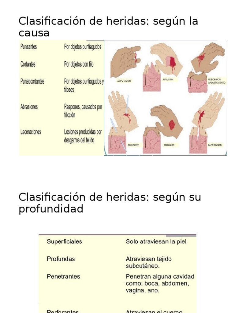 Clasificacin De Heridas Y Su Tratamiento Tipos De Heridas [ 2020 ]