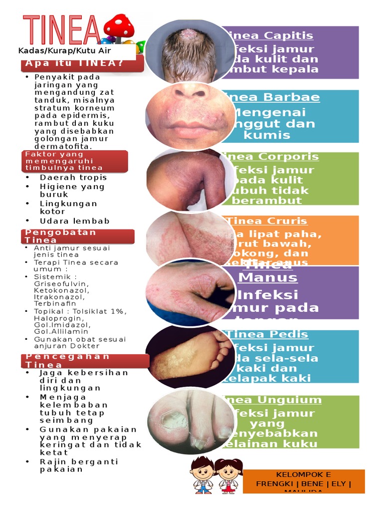 Tinea: Types, Treatment, and Prevention | PDF | Self-Improvement | Wellness