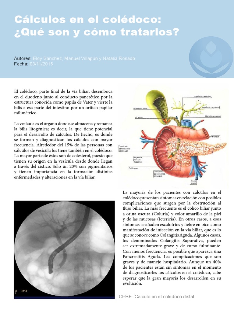 Cálculos en el colédoco: ¿Qué son y cómo tratarlos? | Vesícula biliar ...