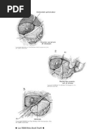 Haggitt's Classification of Malignant Pedunculated | PDF | Colorectal ...