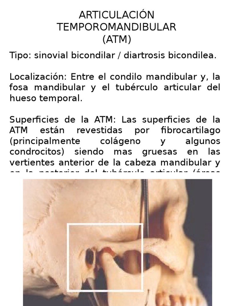 Articulación ATM
