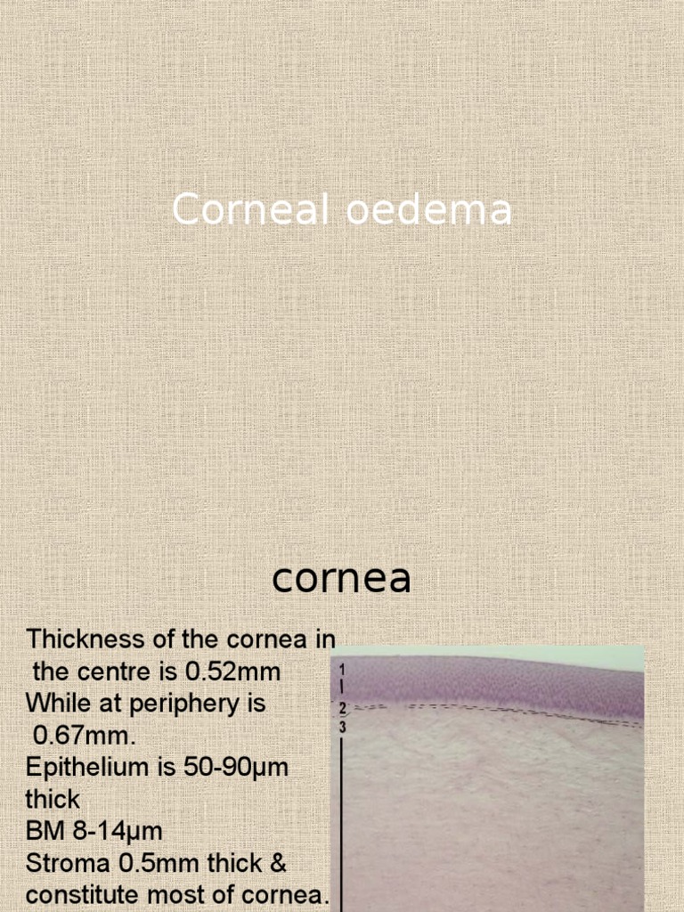 Corneal Edema | PDF | Cornea | Vision