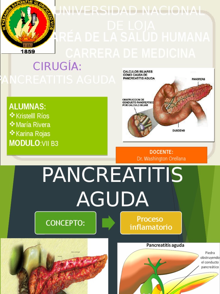 Pancreatitis Aguda | PDF | Páncreas | Especialidades Medicas