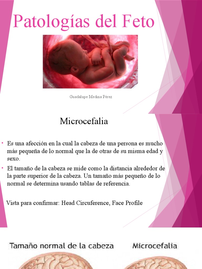 patologias del feto | Trastorno congénito | Sistema nervioso