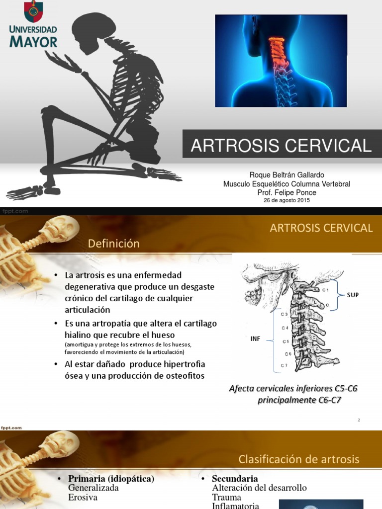 Artrosis Cervical | PDF | Osteoartritis | Cartílago