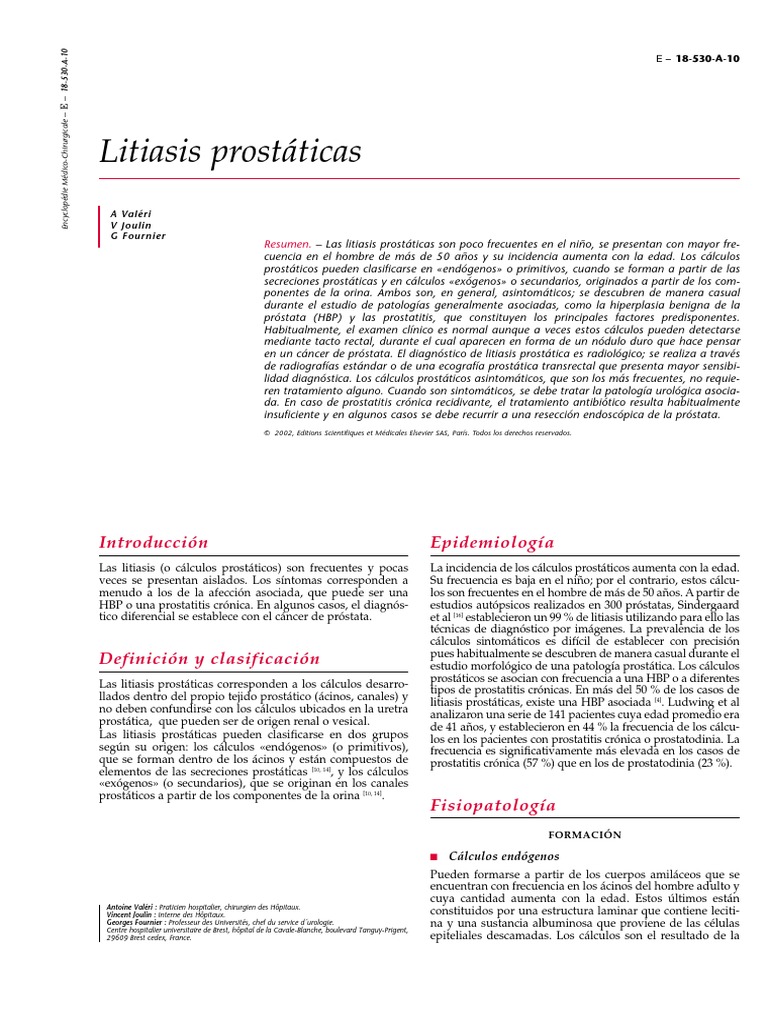 Litiasis Prostática | PDF | Cancer de prostata | Especialidades Medicas