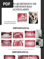 The Ice Chip Protocol | PDF