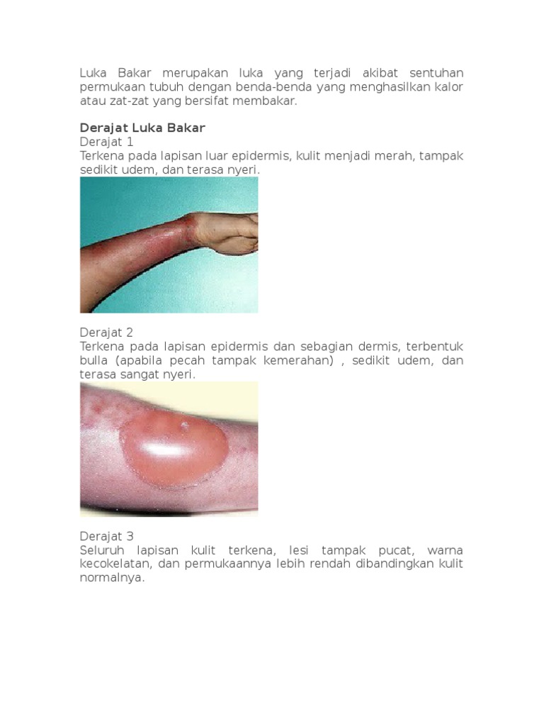 Derajat Luka Bakar | PDF