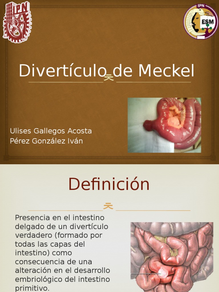 Divertículo de Meckel | PDF | Tracto gastrointestinal | Anatomia animal