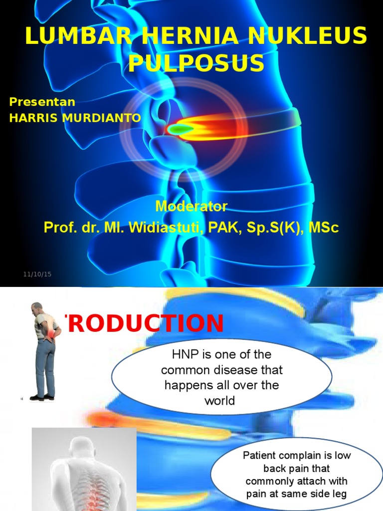 Presentation HNP | Skeletal System | Medical Specialties