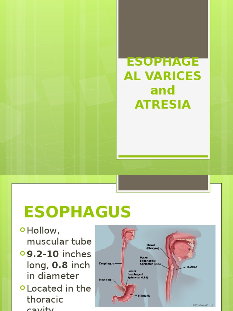 Esophageal Varices and Atresia | Esophagus | Medical Specialties