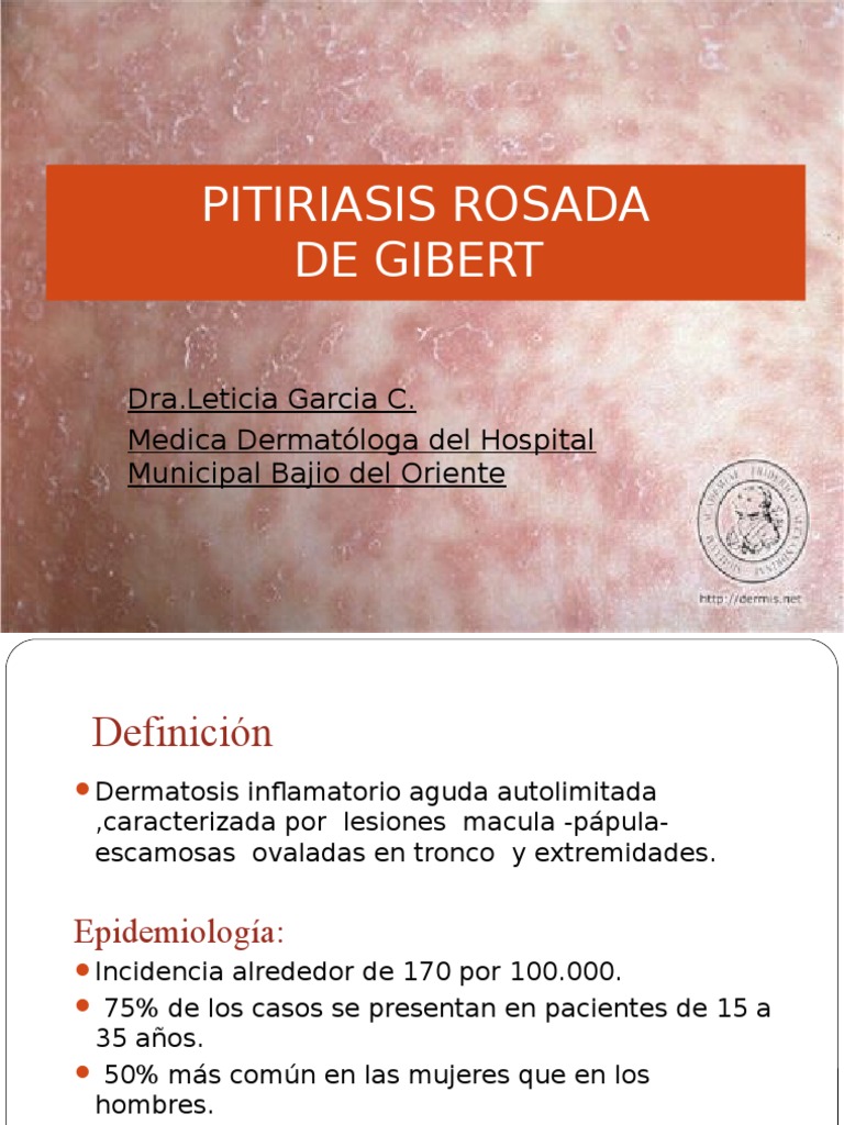 Tratamiento de Pitiriasis Rosada de Gibert | PDF | Rtt | Especialidades ...