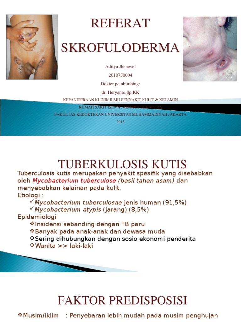 Skrofuloderma | PDF | Pengembangan Diri
