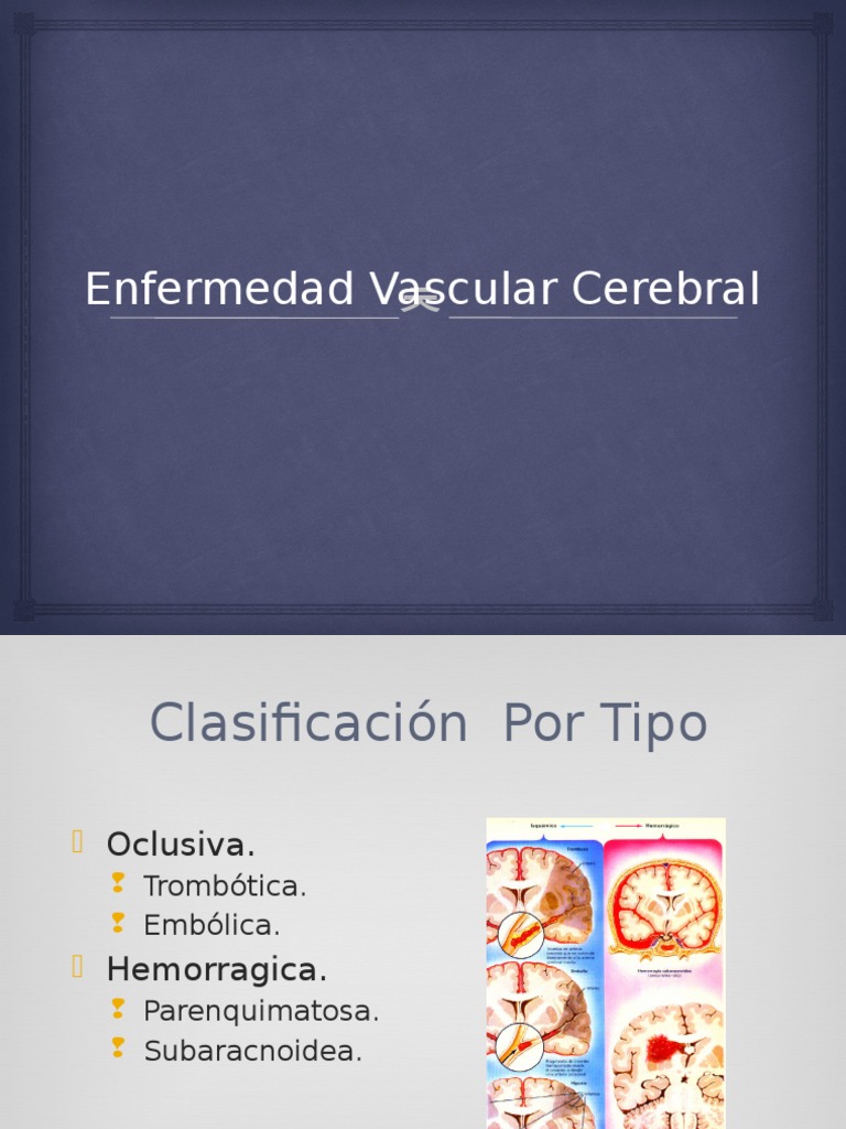 EVC | PDF | Angiología | Especialidades Medicas