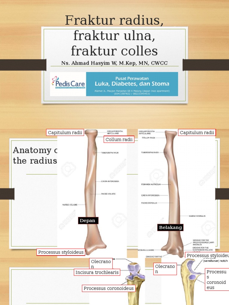 Fraktur Radius, Fraktur Ulna, Fraktur Colles | PDF | Elbow | Traumatology