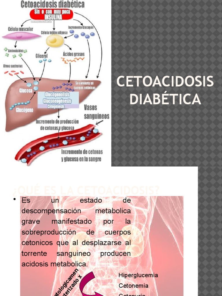 Cetoacidosis Diabética | Diabetes mellitus | Endocrino