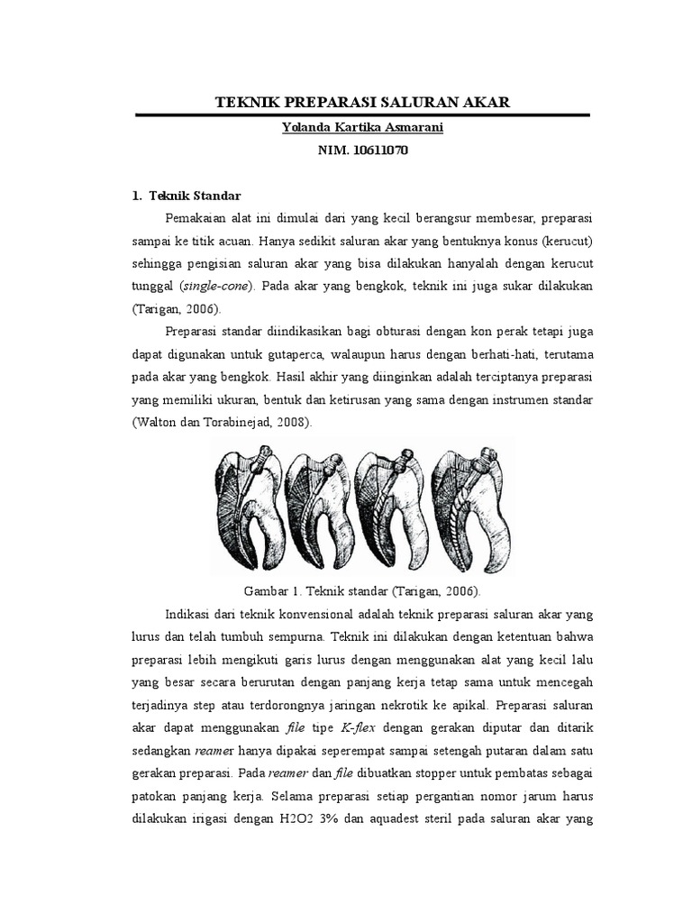 Teknik Preparasi Saluran Akar | PDF | Sains & Matematika