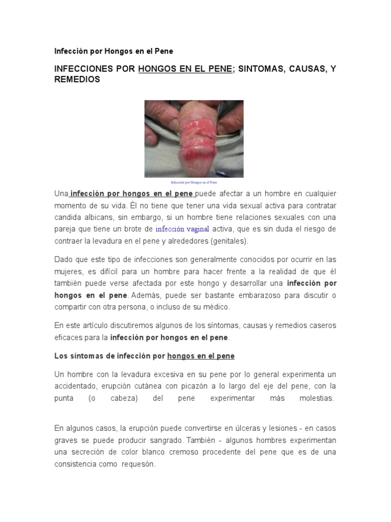 Infección Por Hongos en El Pene