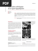 Imagerie de la Selle Turcique | PDF | Imagerie par résonance magnétique ...