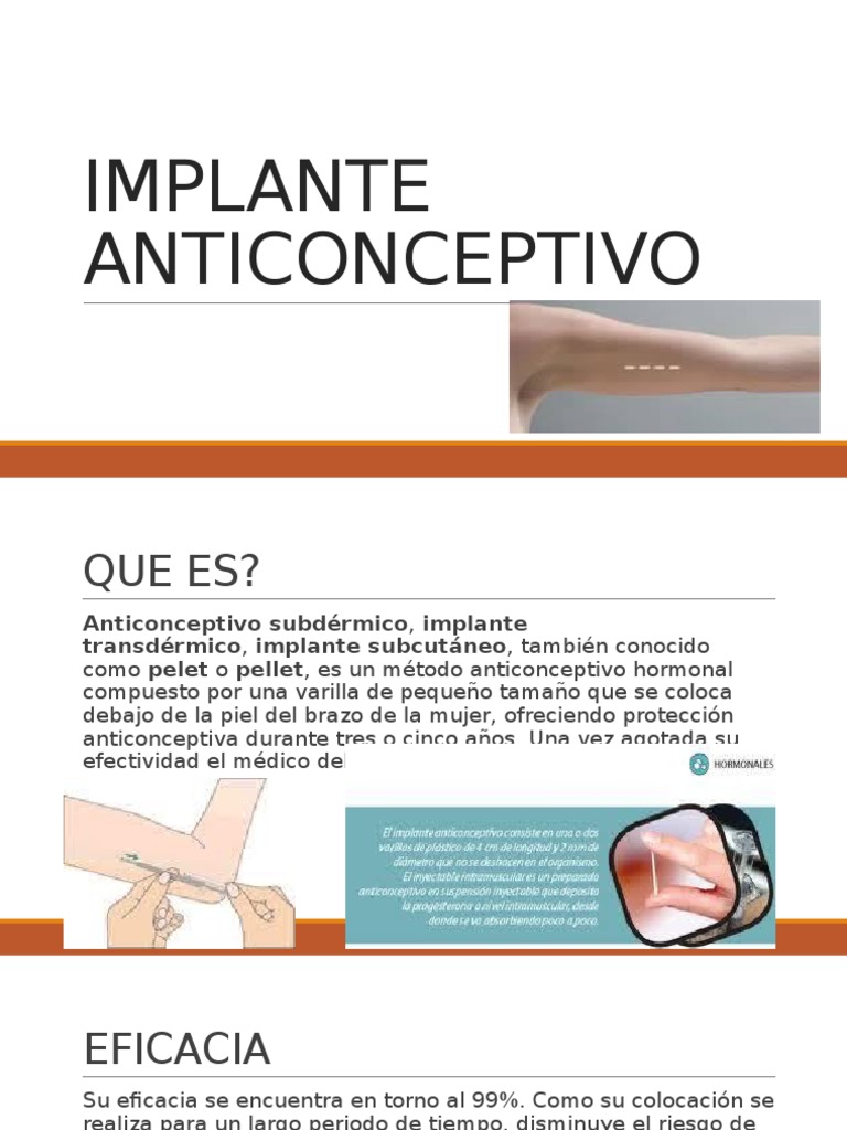 Implante Intradermico | Control de la natalidad | Fertilidad
