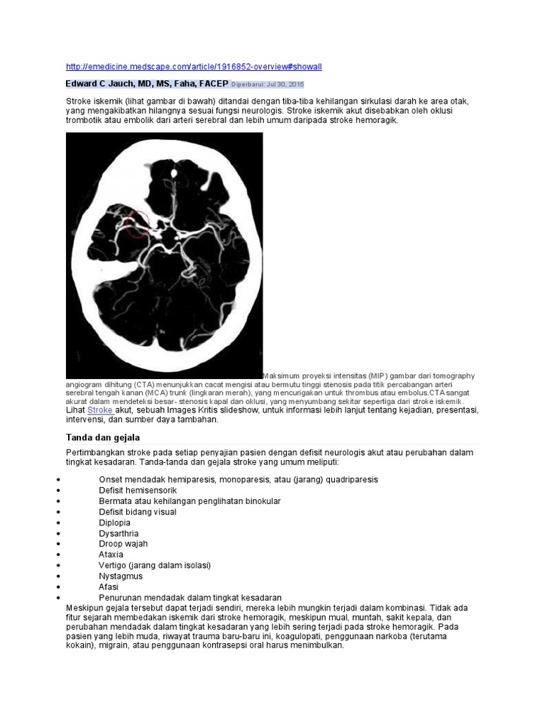 Stroke Iskemik | PDF | Sains & Matematika